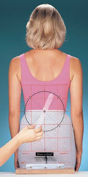 Baseline Posture Evaluation Kit - Grid Only | Medco Sports Medicine
